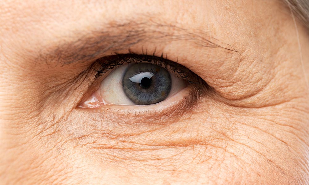 Multiple Signs of Ageing & Deep Wrinkles – elementrē dermo cosmetics