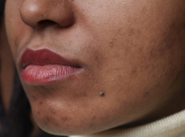 Diagnosis – elementrē dermo cosmetics